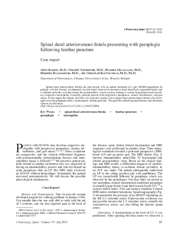 (PDF) Spinal dural arteriovenous fistula presenting with paraplegia ...