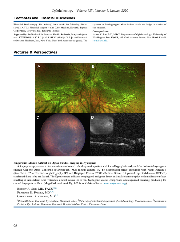 (PDF) Fingerprint Macula Artifact on Optos Fundus Imaging in Nystagmus
