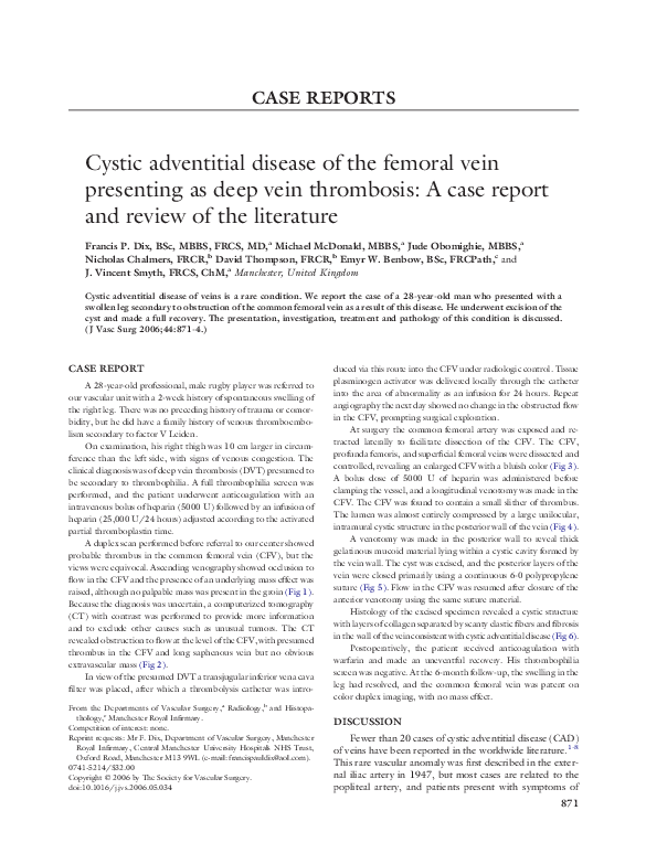 (PDF) Cystic adventitial disease of the femoral vein presenting as deep vein thrombosis: A case ...