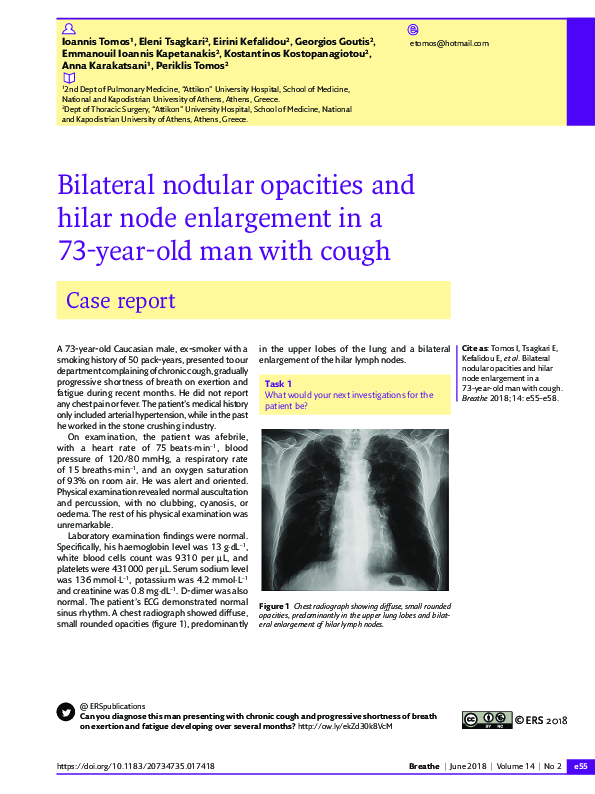 (PDF) Bilateral nodular opacities and hilar node enlargement in a 73 ...
