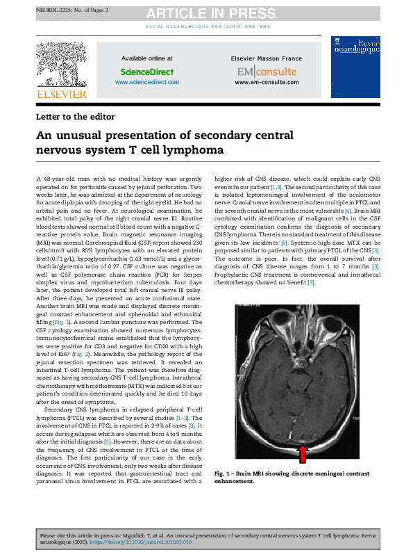 (PDF) An unusual presentation of secondary central nervous system T cell lymphoma | NIZAR ...