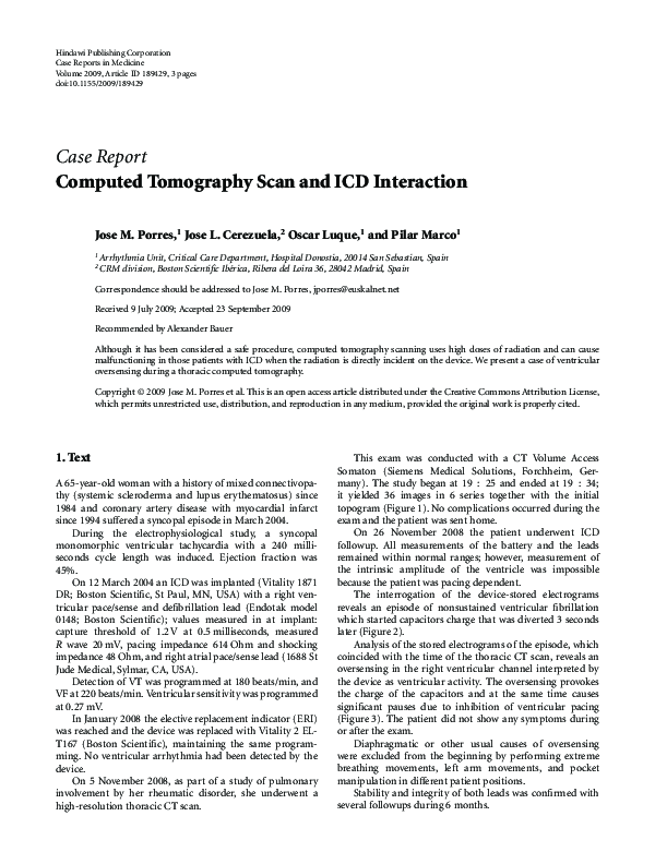 (PDF) Computed Tomography Scan and ICD Interaction