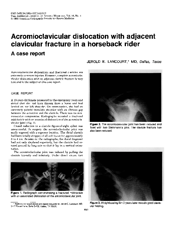 (PDF) Acromioclavicular dislocation with adjacent clavicular fracture ...
