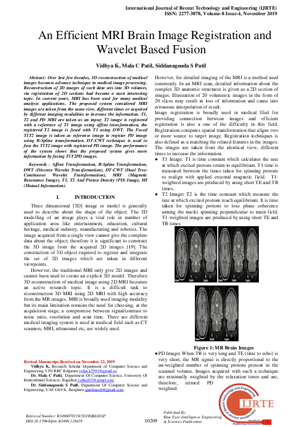 (PDF) An Efficient MRI Brain Image Registration and Wavelet Based Fusion