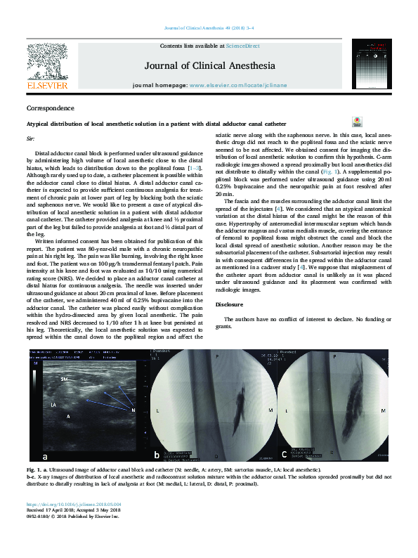 (PDF) Atypical distribution of local anesthetic solution in a patient ...