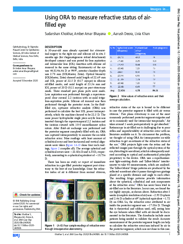 (PDF) Using ORA to measure refractive status of air-filled eye