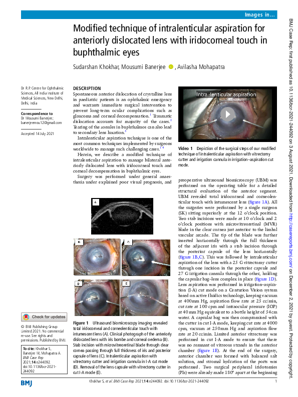 (PDF) Modified technique of intralenticular aspiration for anteriorly ...