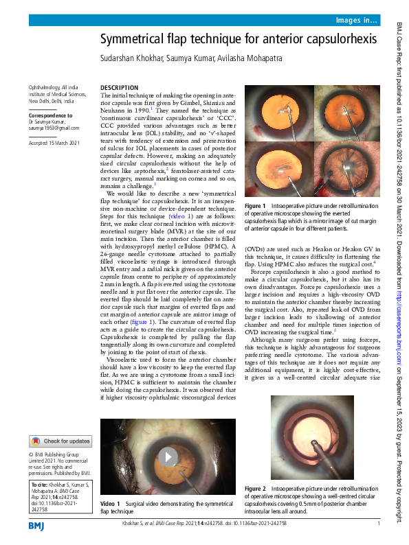 (PDF) Symmetrical flap technique for anterior capsulorhexis