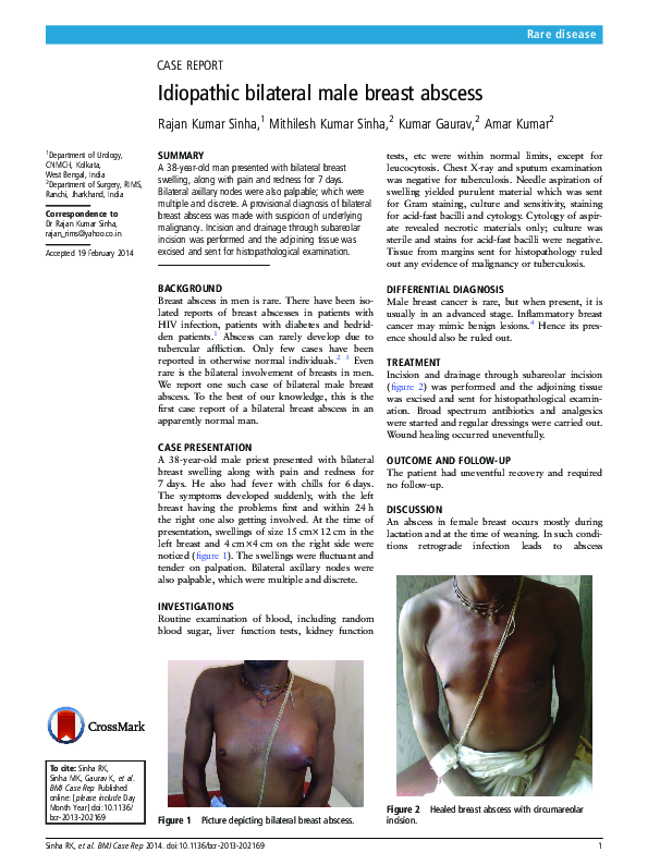 (PDF) Idiopathic bilateral male breast abscess