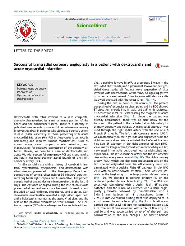 (PDF) Successful transradial coronary angioplasty in a patient with ...