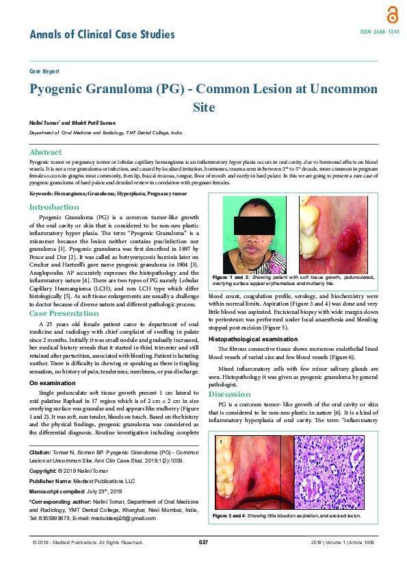 (PDF) Pyogenic Granuloma ( PG )-Common Lesion at Uncommon Site Case Report