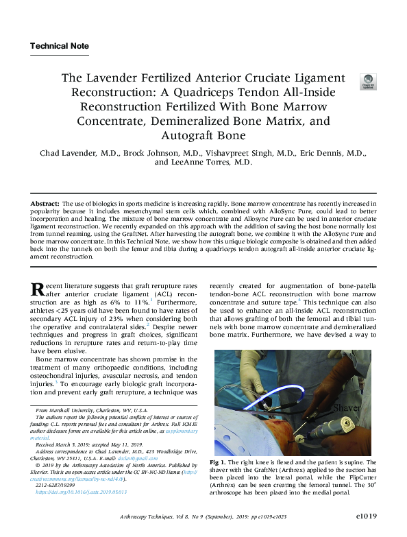 (PDF) The Lavender Fertilized Anterior Cruciate Ligament Reconstruction ...