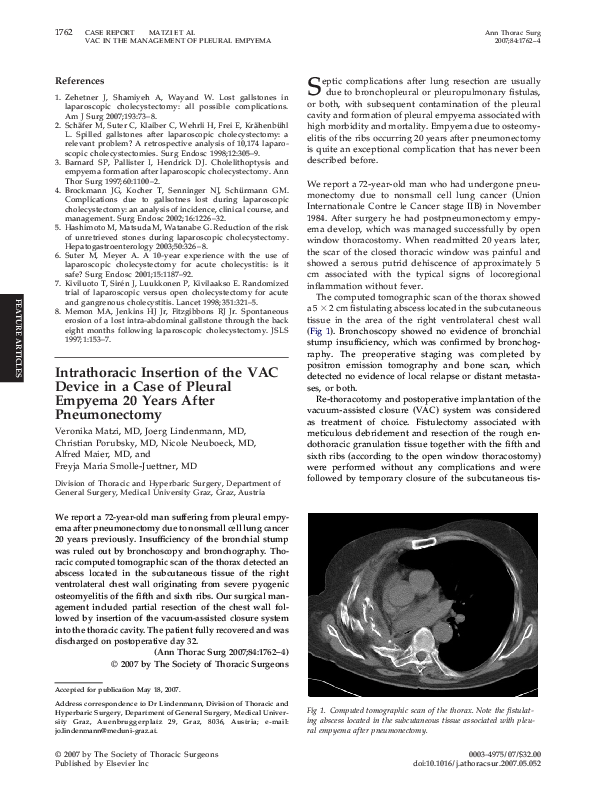 (PDF) Intrathoracic Insertion of the VAC Device in a Case of Pleural ...