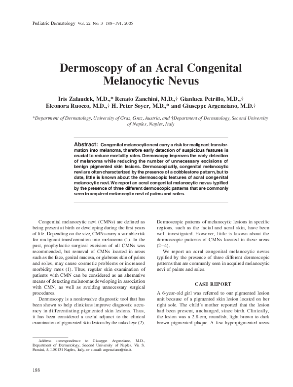 (PDF) Dermoscopy of an Acral Congenital Melanocytic Nevus