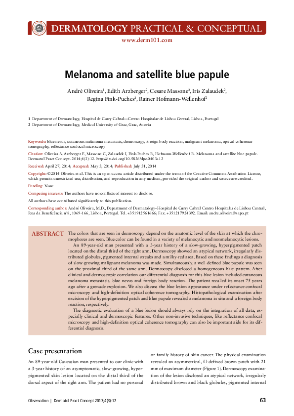 (PDF) Melanoma and satellite blue papule