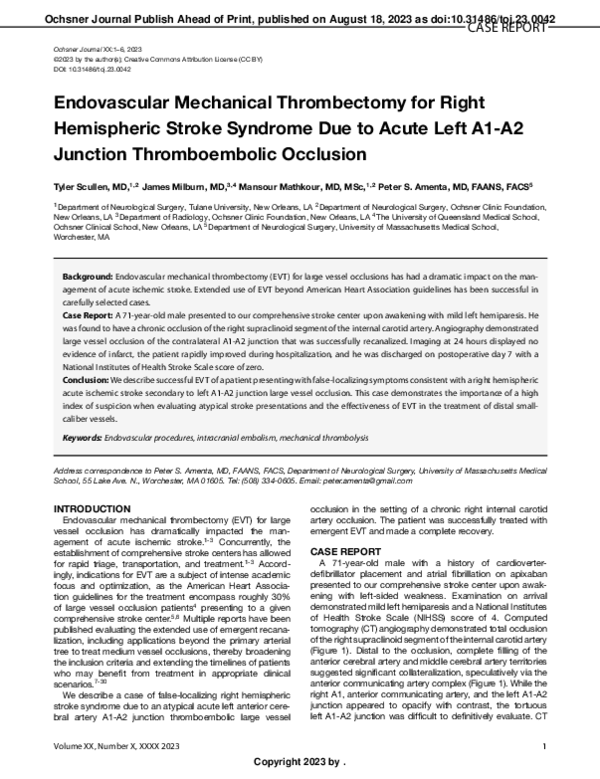 (PDF) Endovascular Mechanical Thrombectomy for Right Hemispheric Stroke ...
