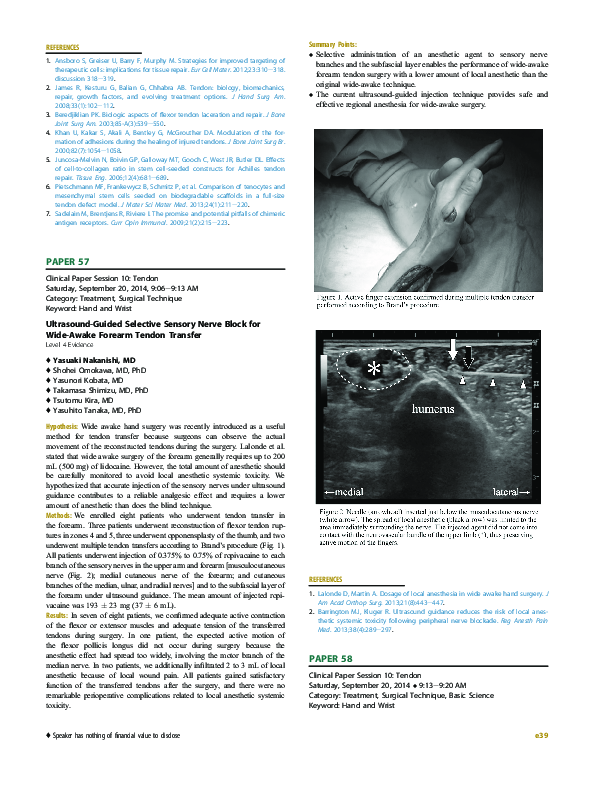 (PDF) Zone II Flexor Tendon Repair Using Knotless Barbed Suture: A ...