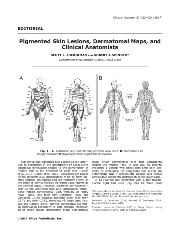(PDF) Pigmented skin lesions, dermatomal maps, and clinical anatomists