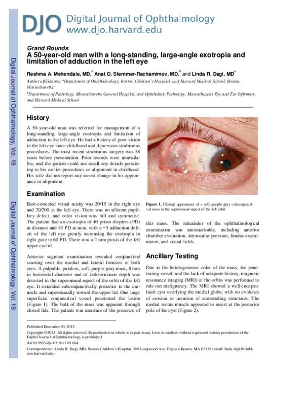 (PDF) Grand Rounds A 50-year-old man with a long-standing, large-angle ...