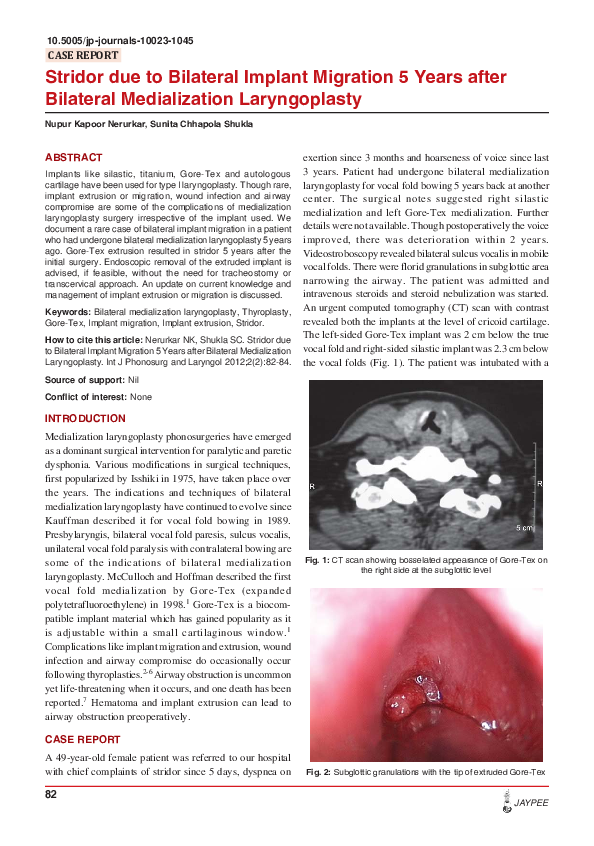 (PDF) Stridor due to Bilateral Implant Migration 5 Years after ...
