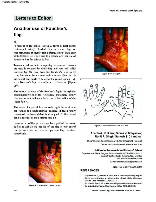 (PDF) Another use of Foucher′s flap