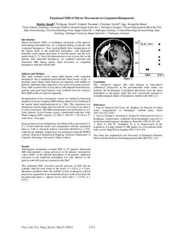 (PDF) Functional MRI of Mirror Movements in Congenital Hemiparesis