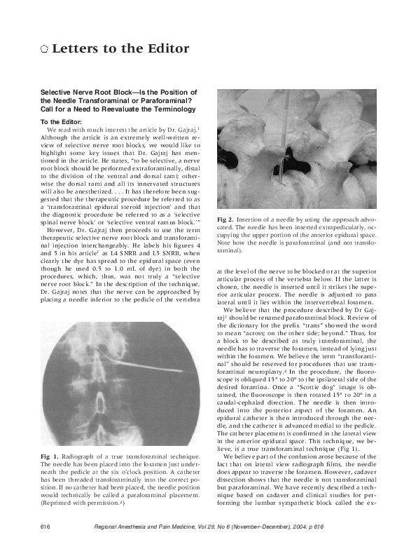 (PDF) Selective nerve root block?Is the position of the needle ...