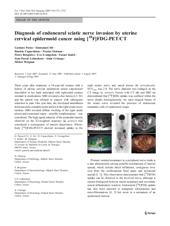 (PDF) Diagnosis of endoneural sciatic nerve invasion by uterine ...