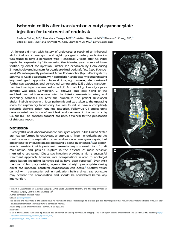 (PDF) Ischemic colitis after translumbar n-butyl cyanoacrylate injection for treatment of endoleak