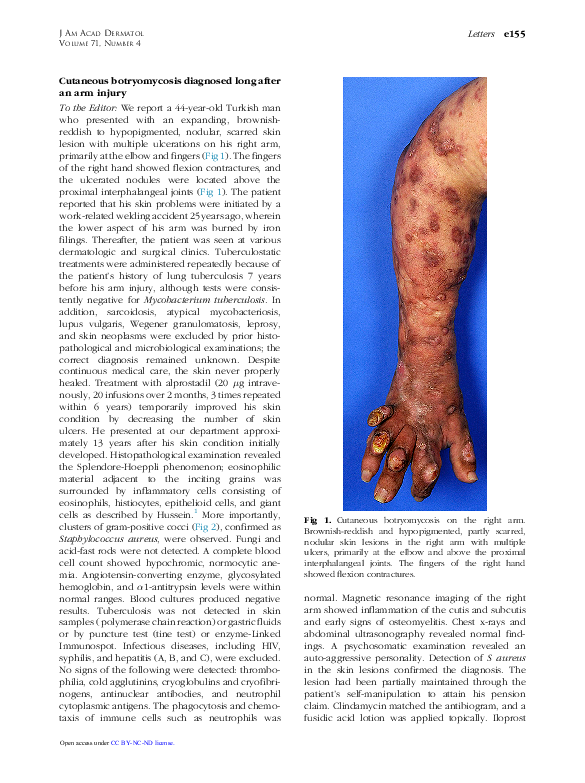 (PDF) Cutaneous botryomycosis diagnosed long after an arm injury