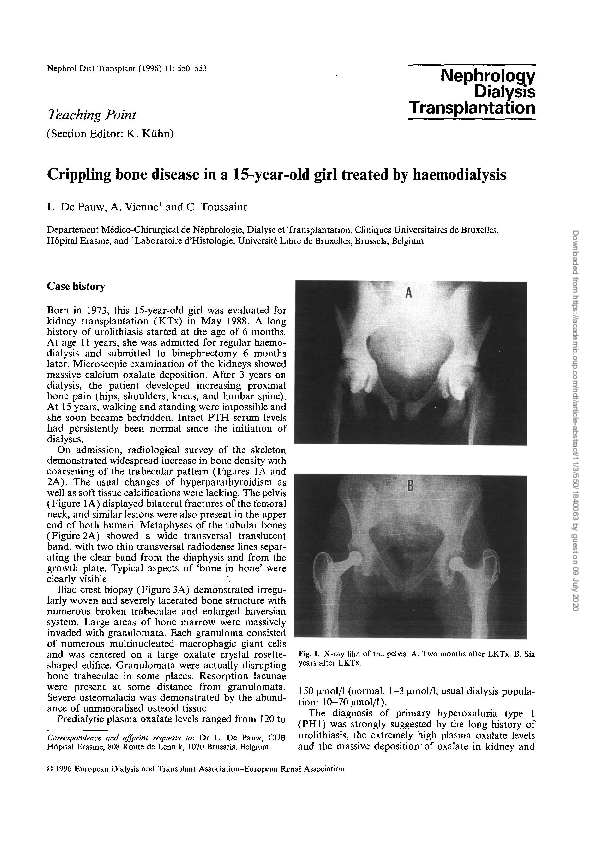 (PDF) Crippling bone disease in a 15-year-old girl treated by haemodialysis