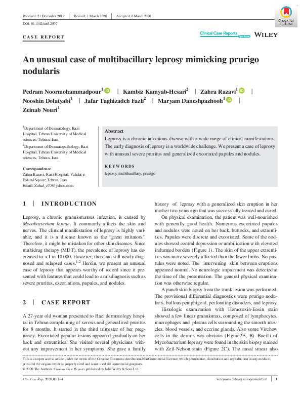 (PDF) An unusual case of multibacillary leprosy mimicking prurigo nodularis
