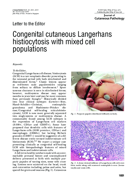 (PDF) Congenital cutaneous Langerhans histiocytosis with mixed cell ...