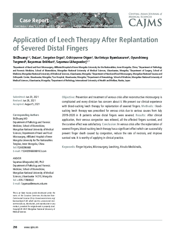 (PDF) Application of Leech Therapy After Replantation of Severed Distal ...