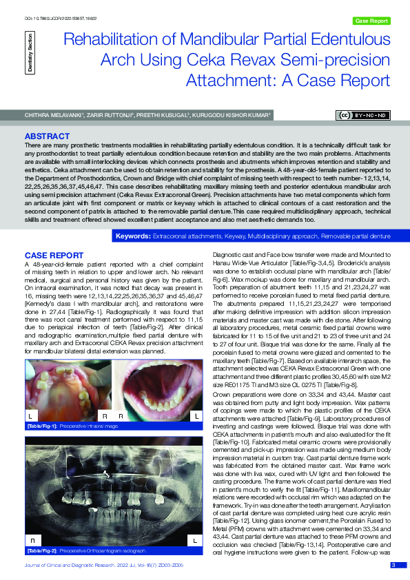 (PDF) Rehabilitation of Mandibular Partial Edentulous Arch Using Ceka ...