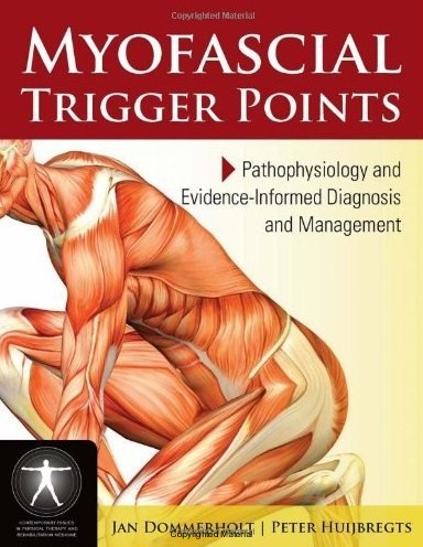 (PDF) Myofascial trigger points