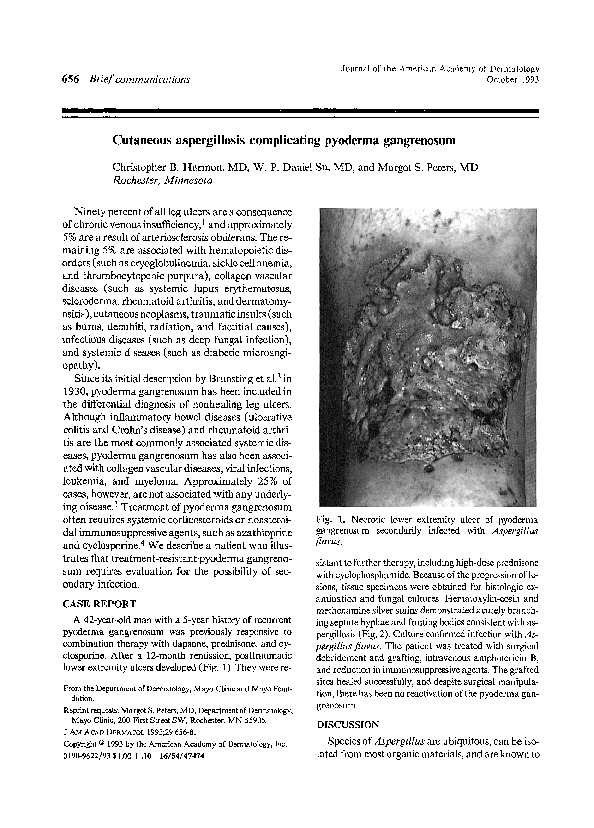(PDF) Cutaneous aspergillosis complicating pyoderma gangrenosum