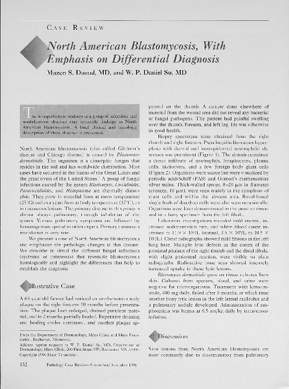(PDF) North American Blastomycosis, With Emphasis on Differential Diagnosis