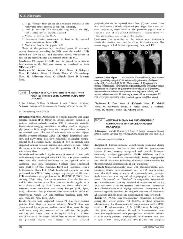 (PDF) O-033 Jugular Vein Flow Patterns in Patients with Pulsatile ...