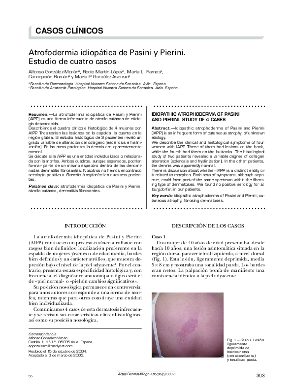 (PDF) Atrofodermia idiopática de Pasini y Pierini. Estudio de cuatro casos