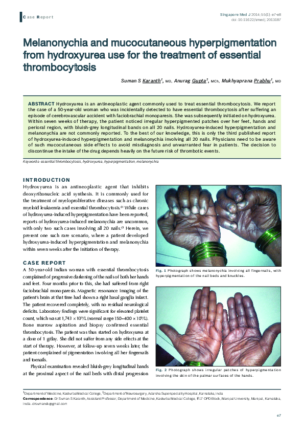 (PDF) Melanonychia and mucocutaneous hyperpigmentation from hydroxyurea ...