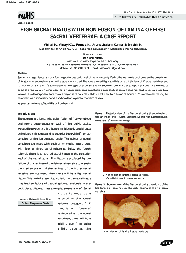 (PDF) High Sacral Hiatus with Non Fusion of Lamina of First Sacral ...