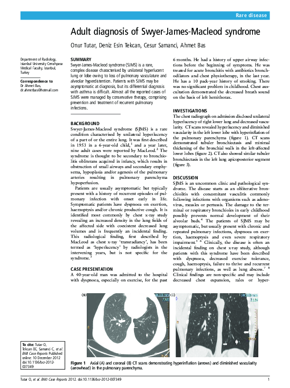 (PDF) Adult diagnosis of Swyer-James-Macleod syndrome