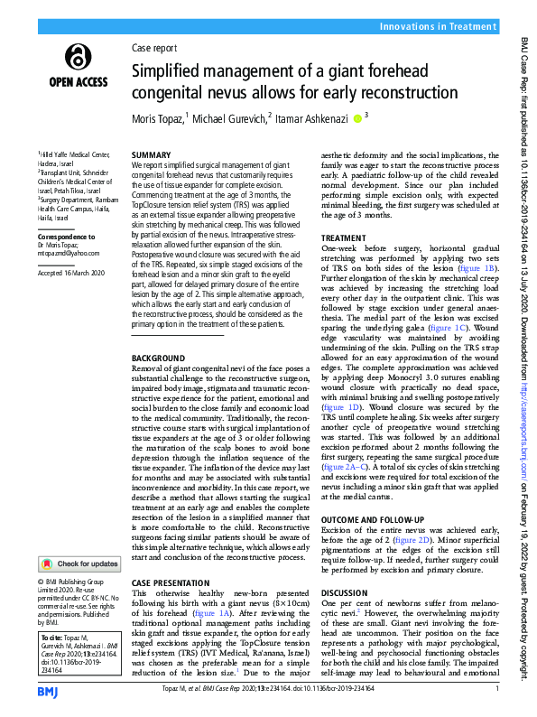(PDF) Simplified management of a giant forehead congenital nevus allows ...