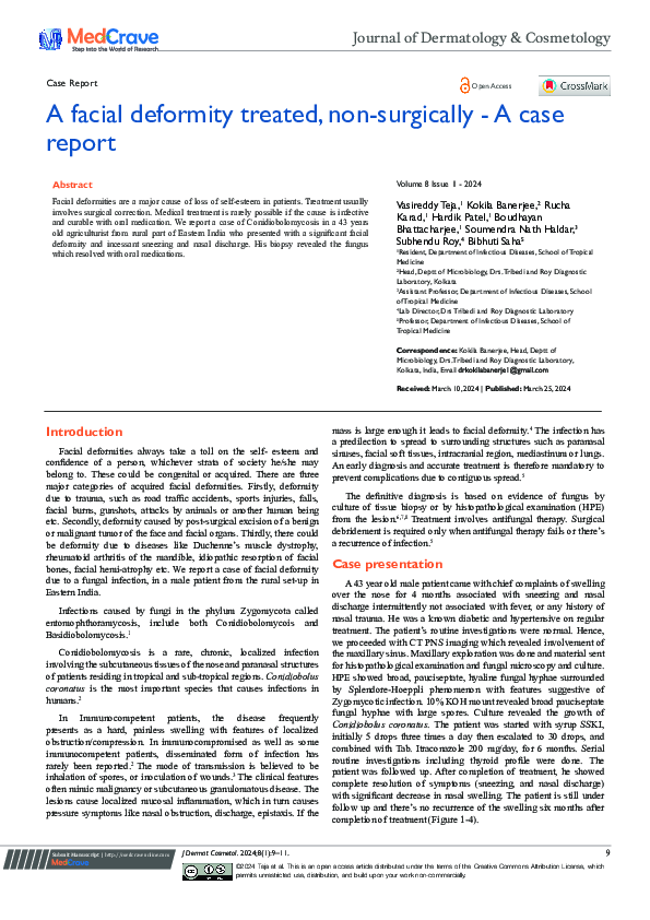 (PDF) A facial deformity treated, non-surgically - A case report