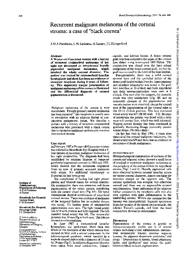 (PDF) Recurrent malignant melanoma of the corneal stroma: a case of ...