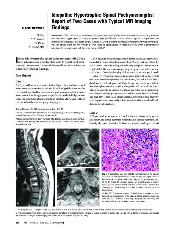 (PDF) Idiopathic Hypertrophic Spinal Pachymeningitis: Report of Two ...