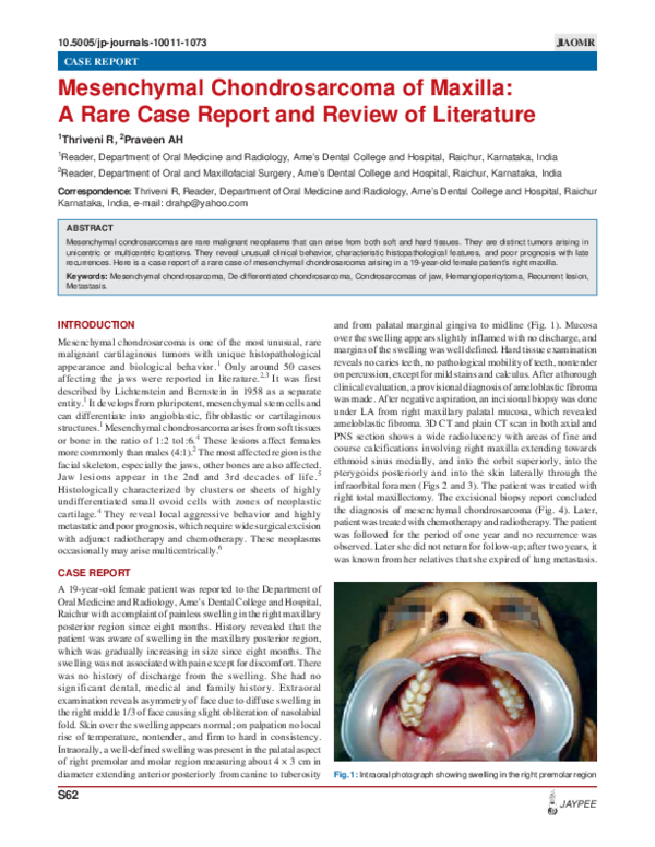 (PDF) Mesenchymal Chondrosarcoma of maxilla: A rare case report