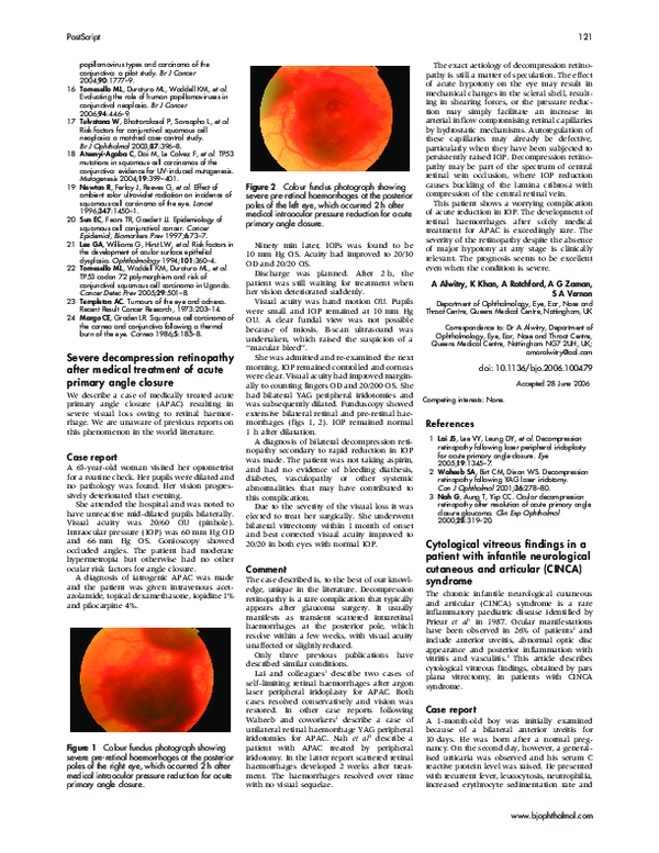 (PDF) Cytological vitreous findings in a patient with infantile ...