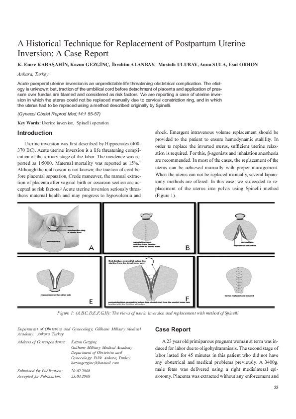 (PDF) A Historical Technique for Replacement of Postpartum Uterine ...
